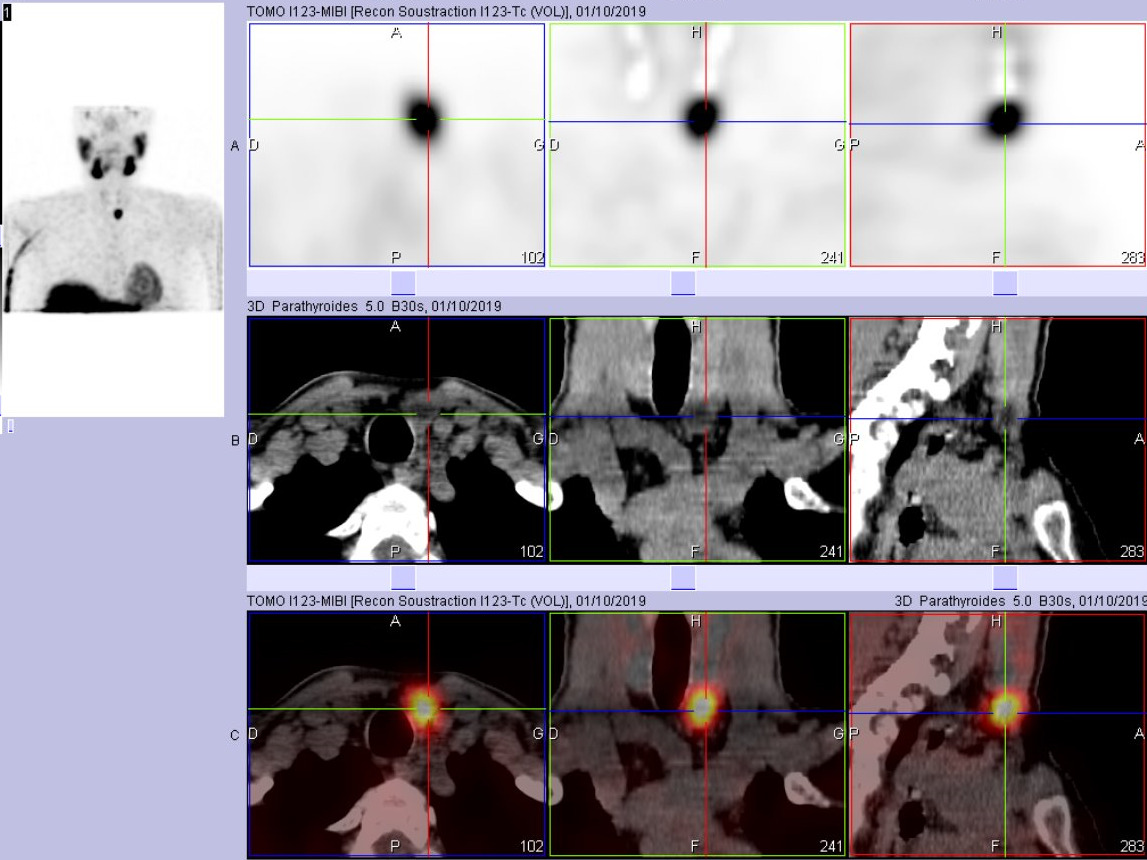 Chirurgie endocrinienne - Les Hôpitaux Universitaires de Strasbourg
